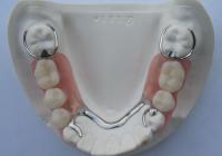 Flexibele protheses - DentallXS